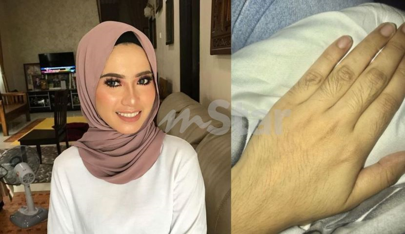 Dek Kerana Misai Tangan Berbulu Gadis Handsome Dilamar Tapi Respons Ibunya Aduhai Selamba